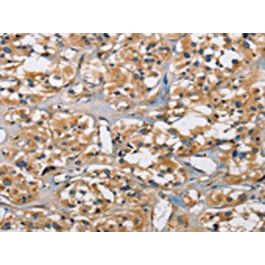 PPP3CA Antibody | ARP American Research Products, Inc.