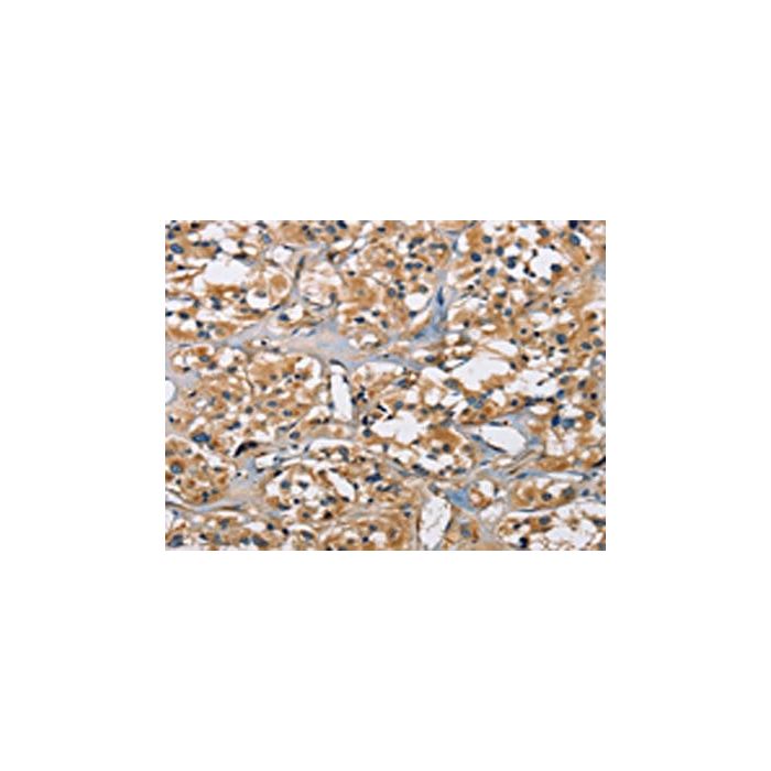 PPP3CA Antibody | ARP American Research Products, Inc.